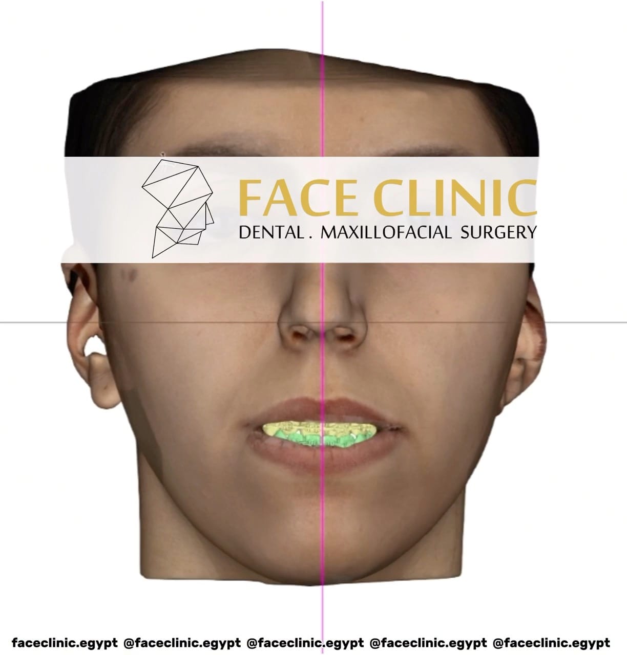 Oral and Maxillofacial Surgery - Face Clinic